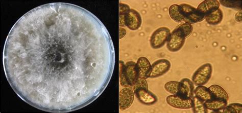 Morphological And Microscopic Presentation Of Botryodiplodia Theobromae