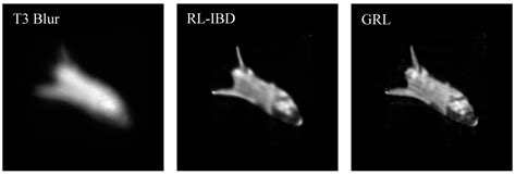 Richardsonlucy Iterative Blind Deconvolution With Gaussian Total Variation Constraints For