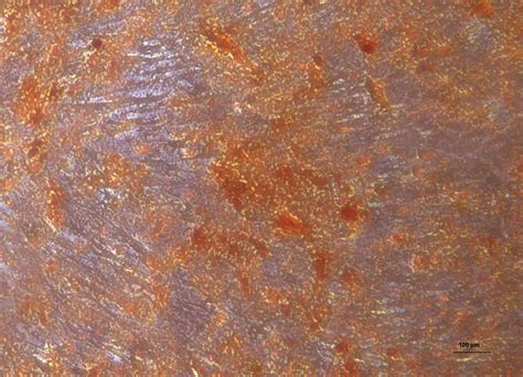 Isolation Culture And Characterization Of Dental Pulp Stem Cells From Human Deciduous And