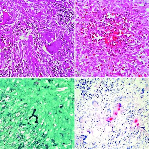 Strains Of Pythium Insidiosum Used For Generation Of The RDNA Based Download Scientific Diagram