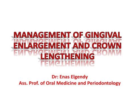 Gingivectomy Ppt