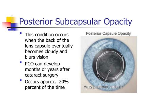 Ppt Comprehensive Overview Of Cataract Treatment And Surgery