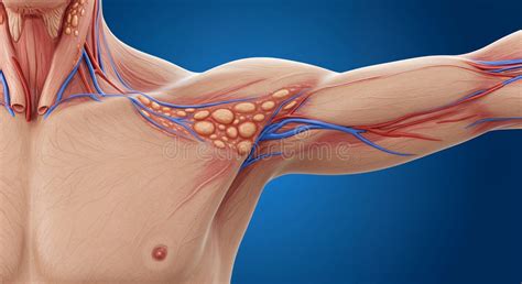 Detailed Medical Illustration Of Scleroderma Affecting Upper Body Skin