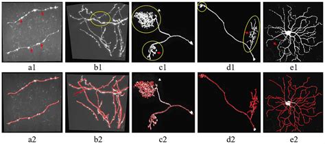 Frontiers Automated Neuron Tracing Using Content Aware Adaptive Voxel