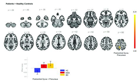 Functional Connectivity Of The Right Anterior Insula Seed In The Download Scientific Diagram