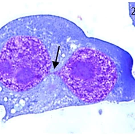 Binucleated Wil2 Ns Cells Following Incubation In Ar Plasma Jet Treated