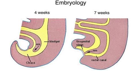 Urogenital Sinus Embryology