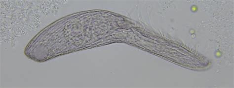 What Is Blepharisma Microscope Clarity