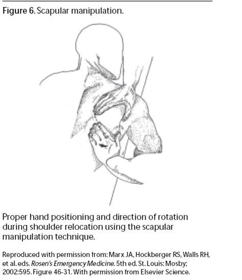 It Is Very Important To Reassess The Shoulder Examination Following