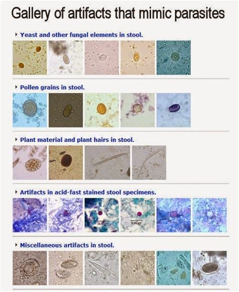 Stool Examination Chart At Jennifer Hammes Blog