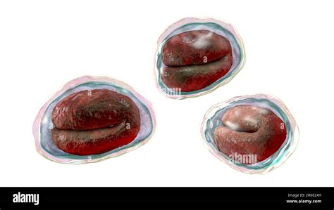 Threadworm Enterobius Vermicularis Eggs Containing Worm Larvae