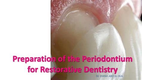 Perio Resorative Inter Relationship Pptx Oral Care Personal Care