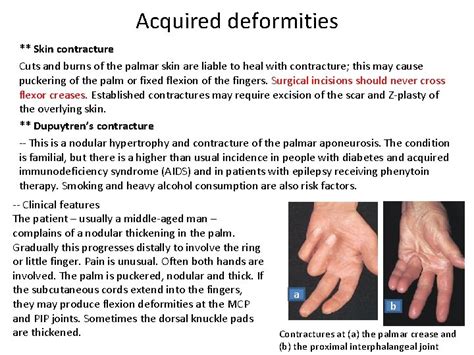 Hand Disorders Mohammad Jomaa Haneen Omar Hand Anatomy
