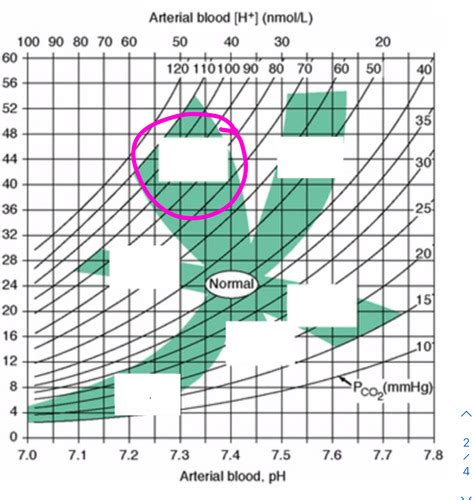 Acid Base Nomogram Flashcards Quizlet