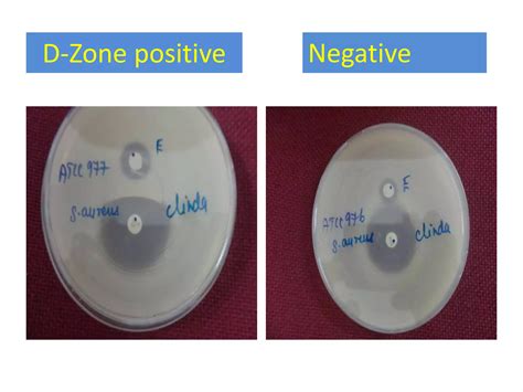 Antimicrobial Susceptibility Testing Disk Diffusion Methods Pptx Infectious Diseases