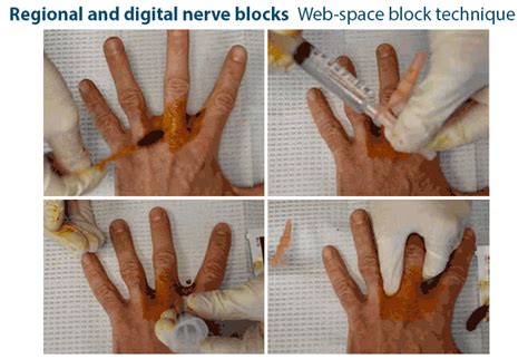 Best Practices Regional Blocks