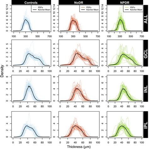Classification Of Drusen Drusen Were Classified According To Their