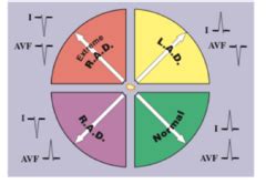 Nursing Bibs Ekg Axis