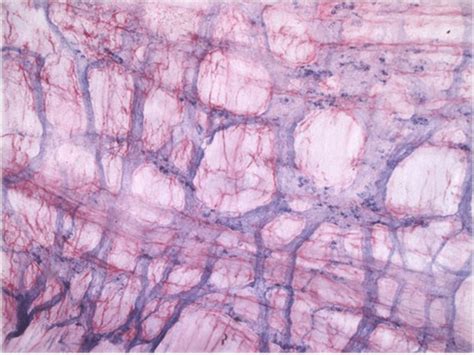 Whole Mount Preparation Of Longitudinal Muscle Of Human Colon Download Scientific Diagram