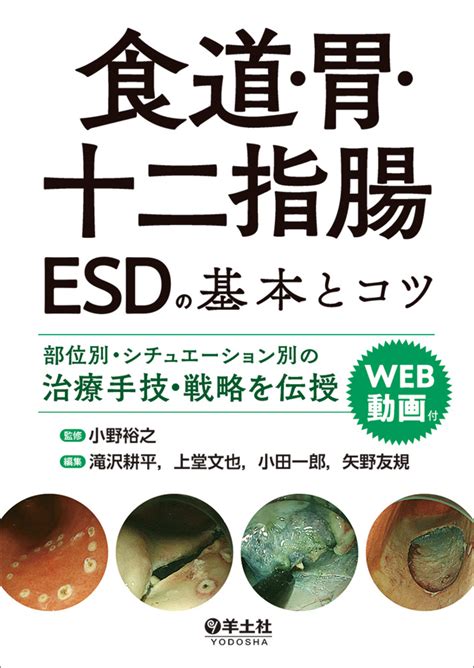 食道・胃・十二指腸esdの基本とコツ〜部位別・シチュエーション別の治療手技・戦略を伝授 羊土社