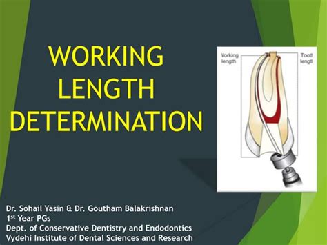 Working Length Determination Pptx