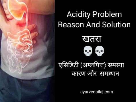 Acidity Problem Solution एसडट क घरल उपय