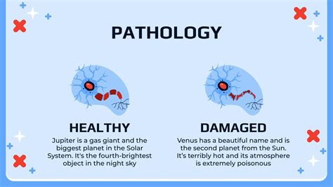Multiple Sclerosis Disease Presentation