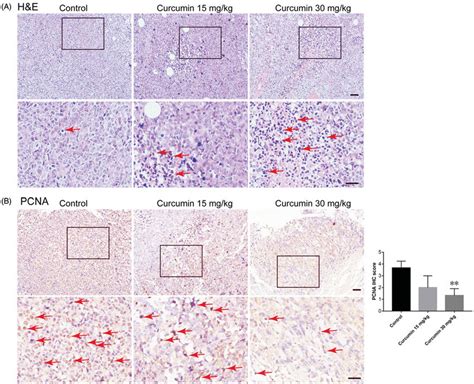 Curcumin Inhibited Tumour Proliferation In Vivo A Paraffin Sections Download Scientific