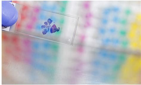 Specimen Tracking For Improved Quality And Patient Safety