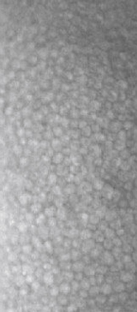 Specular Microscopy Clinical Tree