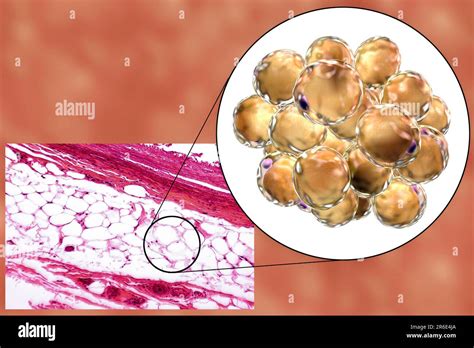 Fat Cells Light Micrograph And Computer Illustration White Adipose Tissue Composed Of