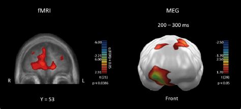 Significant Spatial Fmri Left And Spatio Temporal Meg Right Download Scientific Diagram
