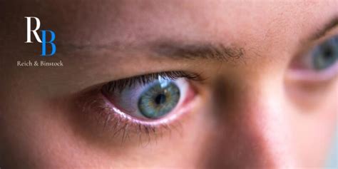 What Are The Tepezza Side Effects Reich And Binstock Houston