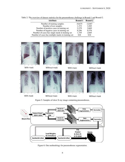 The 2st Unet For Pneumothorax Segmentation In Chest X Rays Using Resnet34 As A Backbone For U