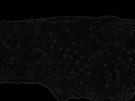 C Morphological Watershed From Markers Filter On Itk Stack Overflow