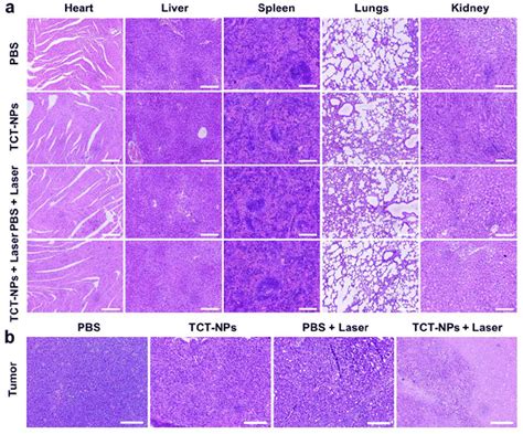 Correction Dad Organic Fluorescent Probes For Nir Ii Fluorescence