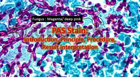 Pas Stain Introduction Principle Procedure Result Interpretation