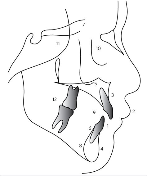 linear and angular measurements used download scientific diagram