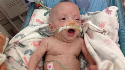 Самые маленькие дети в мире топ 10 малышей которые родились сильно недоношенными