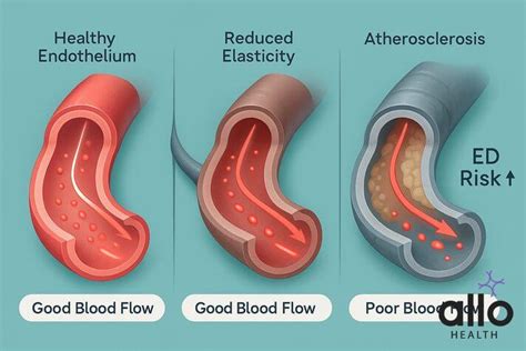 Age And Impotence When Does Erectile Dysfunction Start