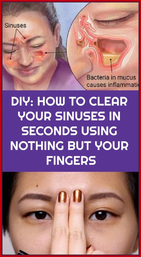 How To Clear Your Sinuses In Seconds Using Nothing But Your Fingers Natural Remedies In 2020