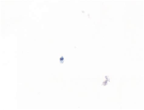 fails to extract regions from mirax image · issue 314 · openslide openslide · github