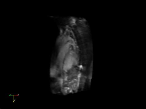 Bayesian Respiratory Motion Model