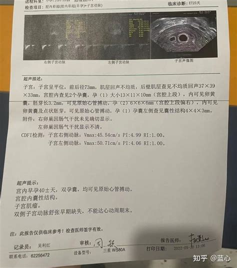 同性恋要付出多少才能拥有一个孩子我的试管经历 知乎
