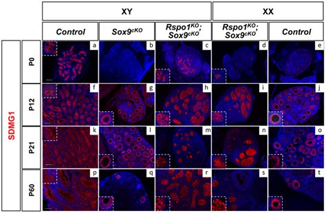 Post Natal Development Of Sex Cords In XY And XX Rspo1KOSox9cKO Download Scientific Diagram