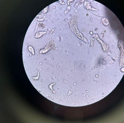 Lab Practical Protists Flashcards Quizlet