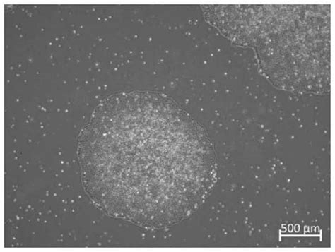 Method For Producing Brain Organoids Eureka Patsnap