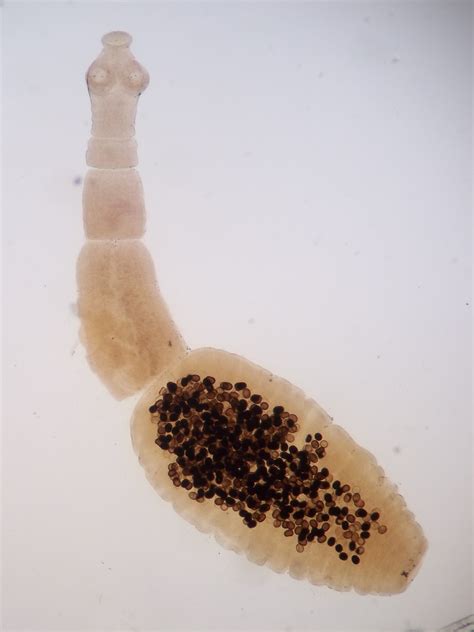 Echinococcus Granulosus Bioquipbugs