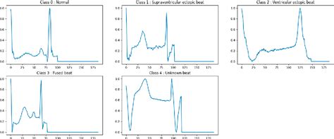 Figure 7 From Electrocardiogram Signals Classification Using Deep