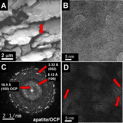 A The Surface Sensitive Secondary Image Of Scanning Electron